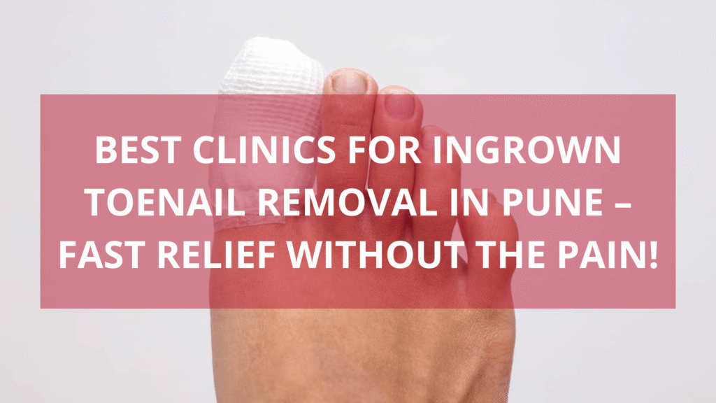 Best Ingrown Toenail Removal Clinics in Pune – Fast Relief